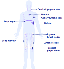 Diffuse large B-cell lymphoma (DLBCL) | Leukaemia Foundation